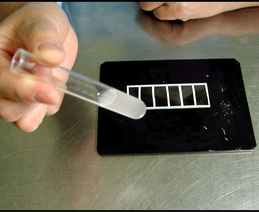 Bacterial Serotyping Antisera - Deben Diagnostics