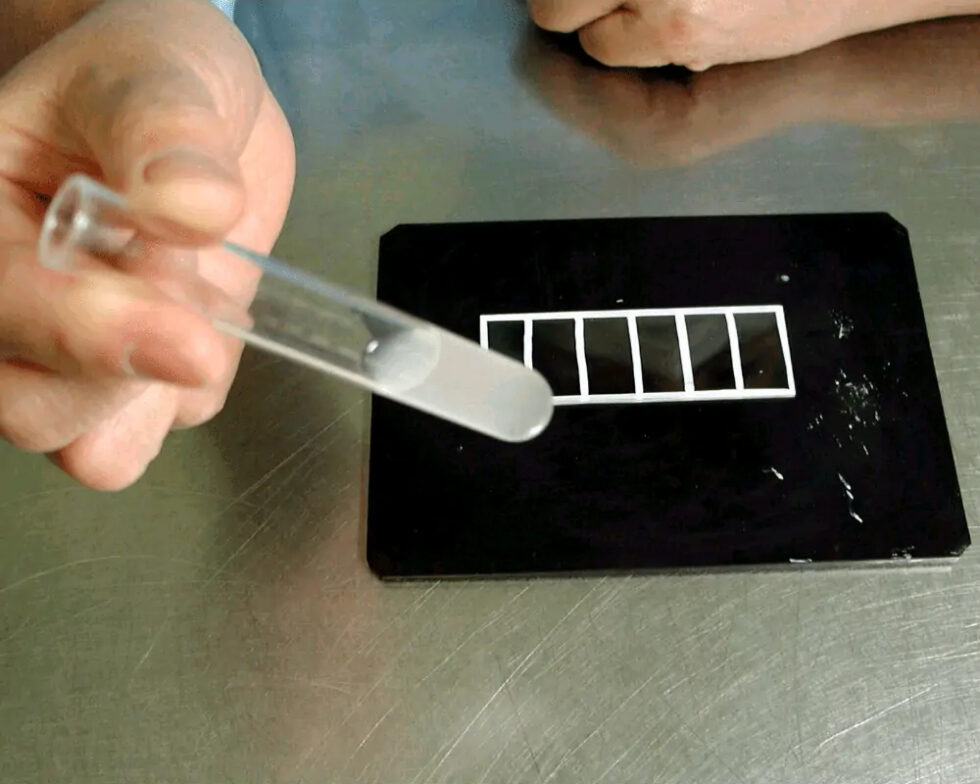 Bacterial Serotyping Antisera - Deben Diagnostics